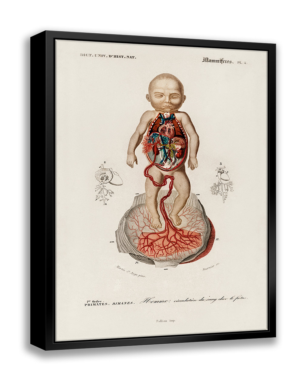 ATX Art Group LLC Circulation Of The Blood In A Fetus - Floater Frame ...