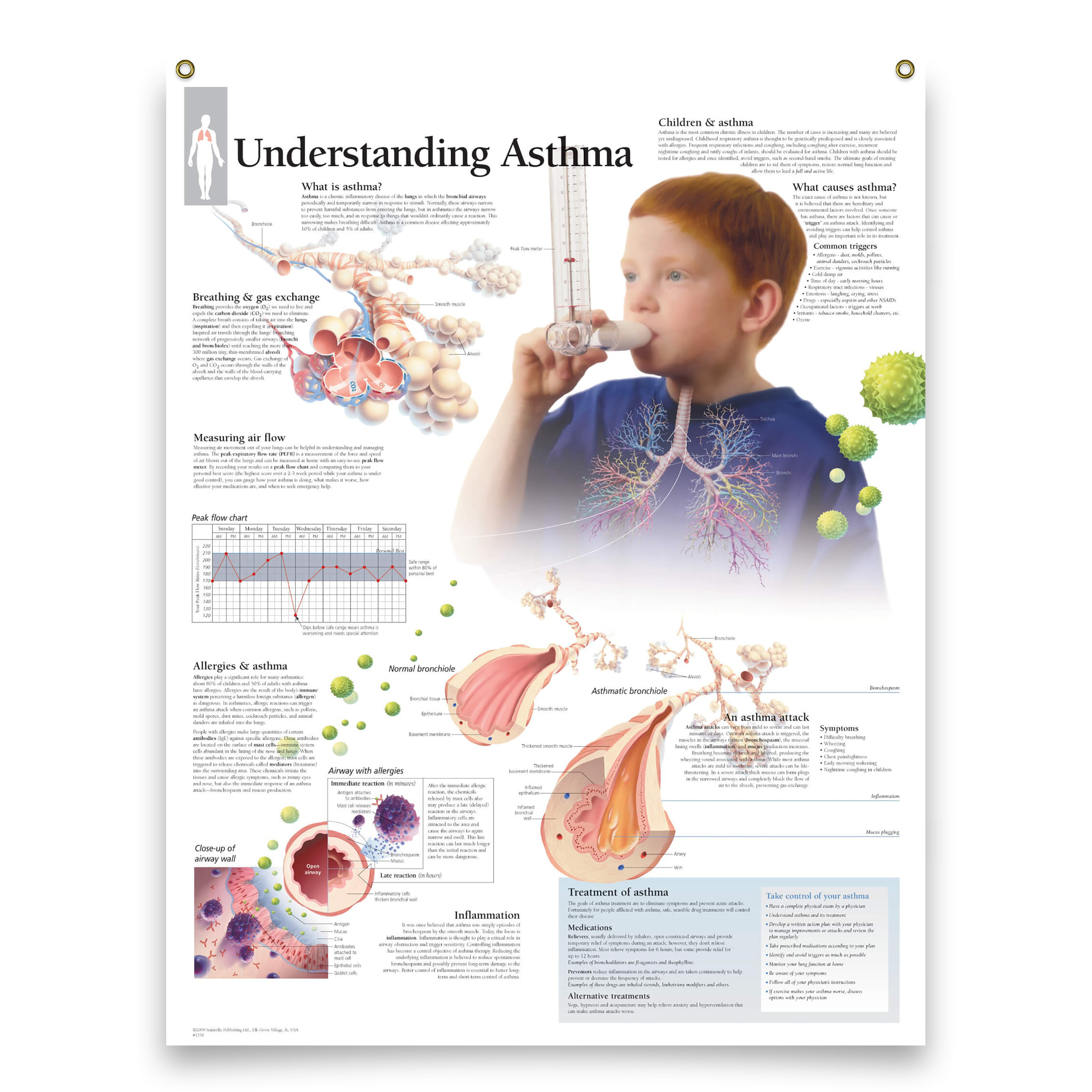 Trinx Set Of 3 Framed Medical Posters: Understanding Asthma, COPD, And ...