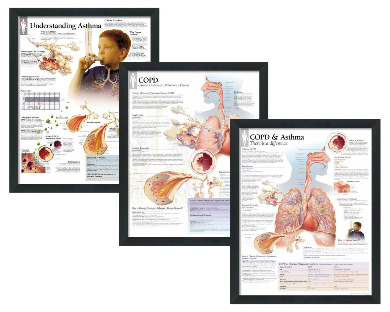 Trinx Jawanda Set Of 3 Framed Medical Posters: Understanding Asthma ...