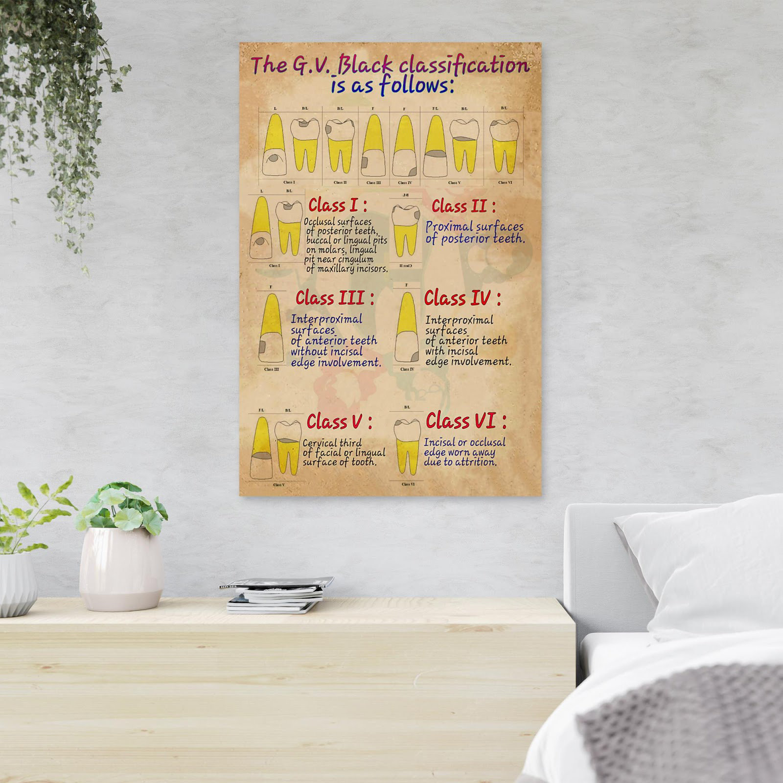 Trinx 6 Types Of Teeth - The G.V Black Classification Is As Follows ...