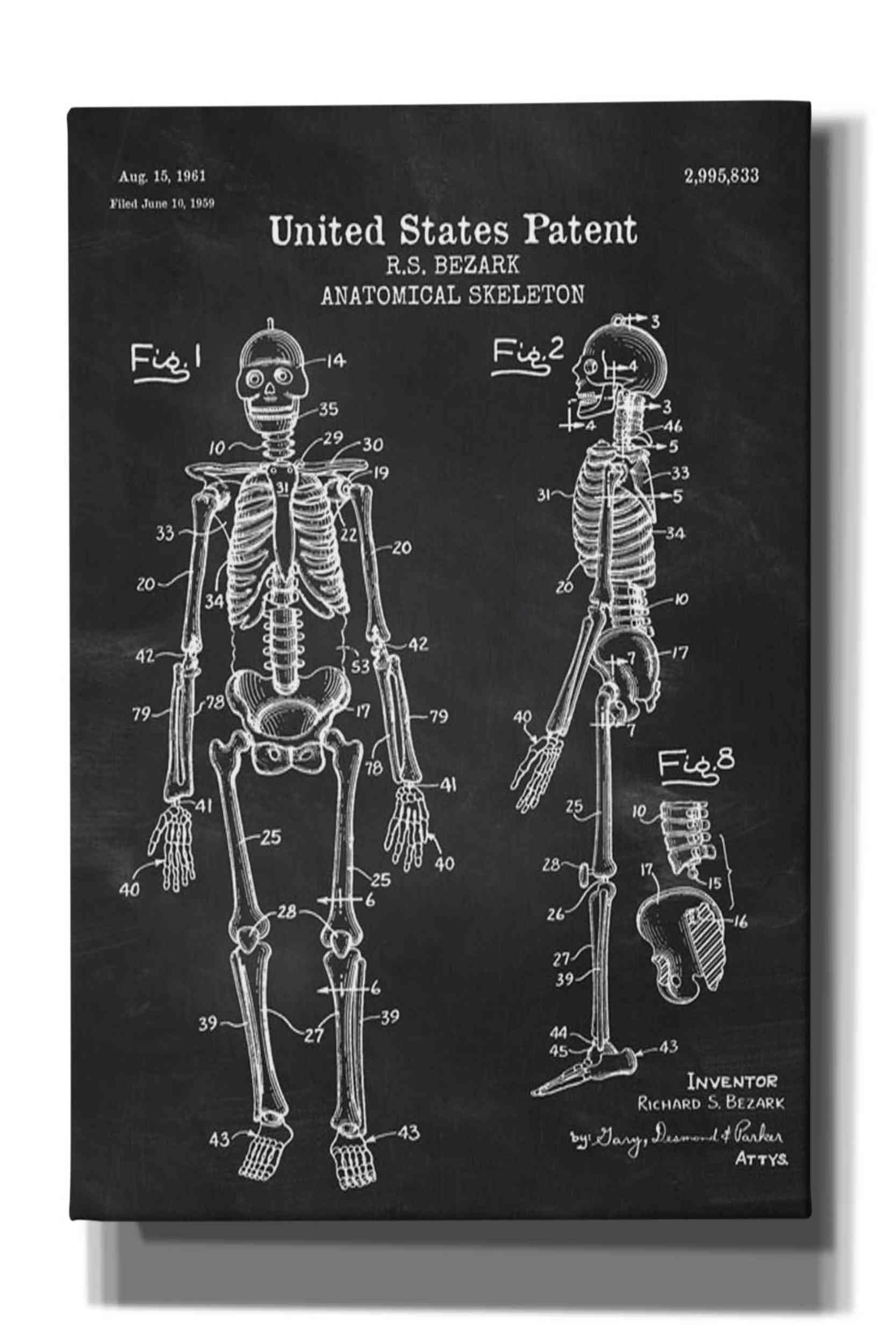 Williston Forge Anatomical Skeleton Blueprint Patent Chalkboard ...