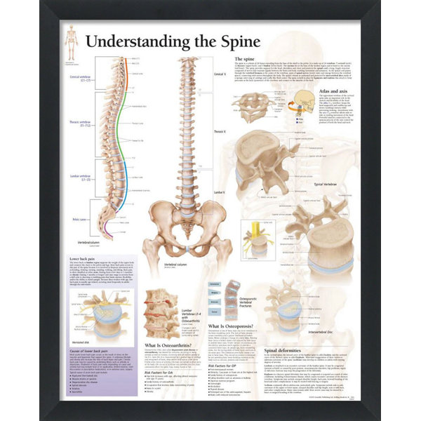 Trinx Jarryn Set Of 3 Framed Medical Posters: The Spine, Dermatomes ...