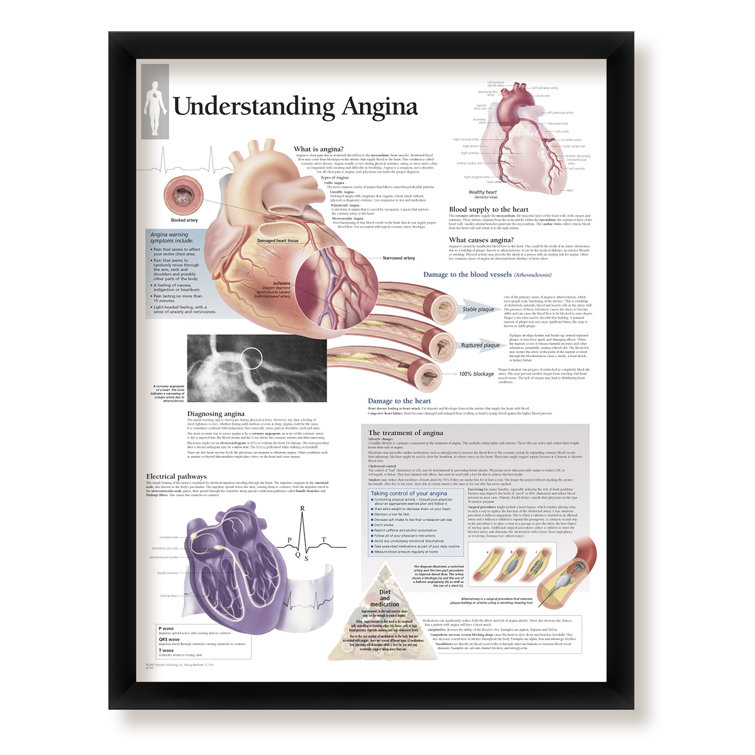 Trinx Understanding Angina Framed Medical Educational Informational ...