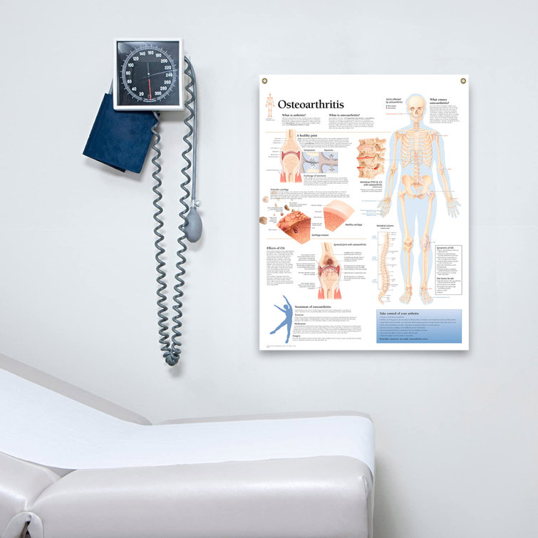 Trinx Set Of 3 Framed Medical Posters: Osteoarthritis Rheumatoid ...