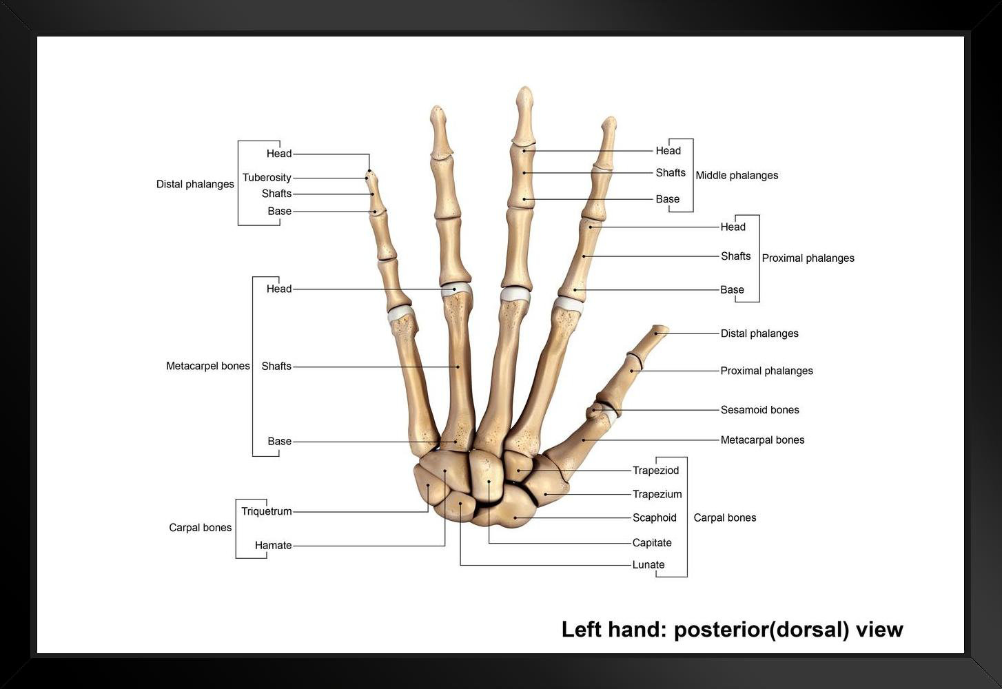 Trinx " Human Left Hand Posterior Dorsal View Bones Anatomy Chart ...