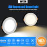 WYZM 12 Pack 6 inch Color Adjustable LED Recessed Downlight with Night ...