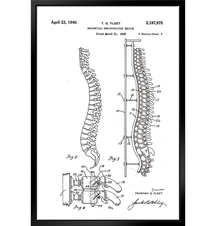ATX Art Group LLC Anatomical Spine Display Patent Framed On Canvas by ...