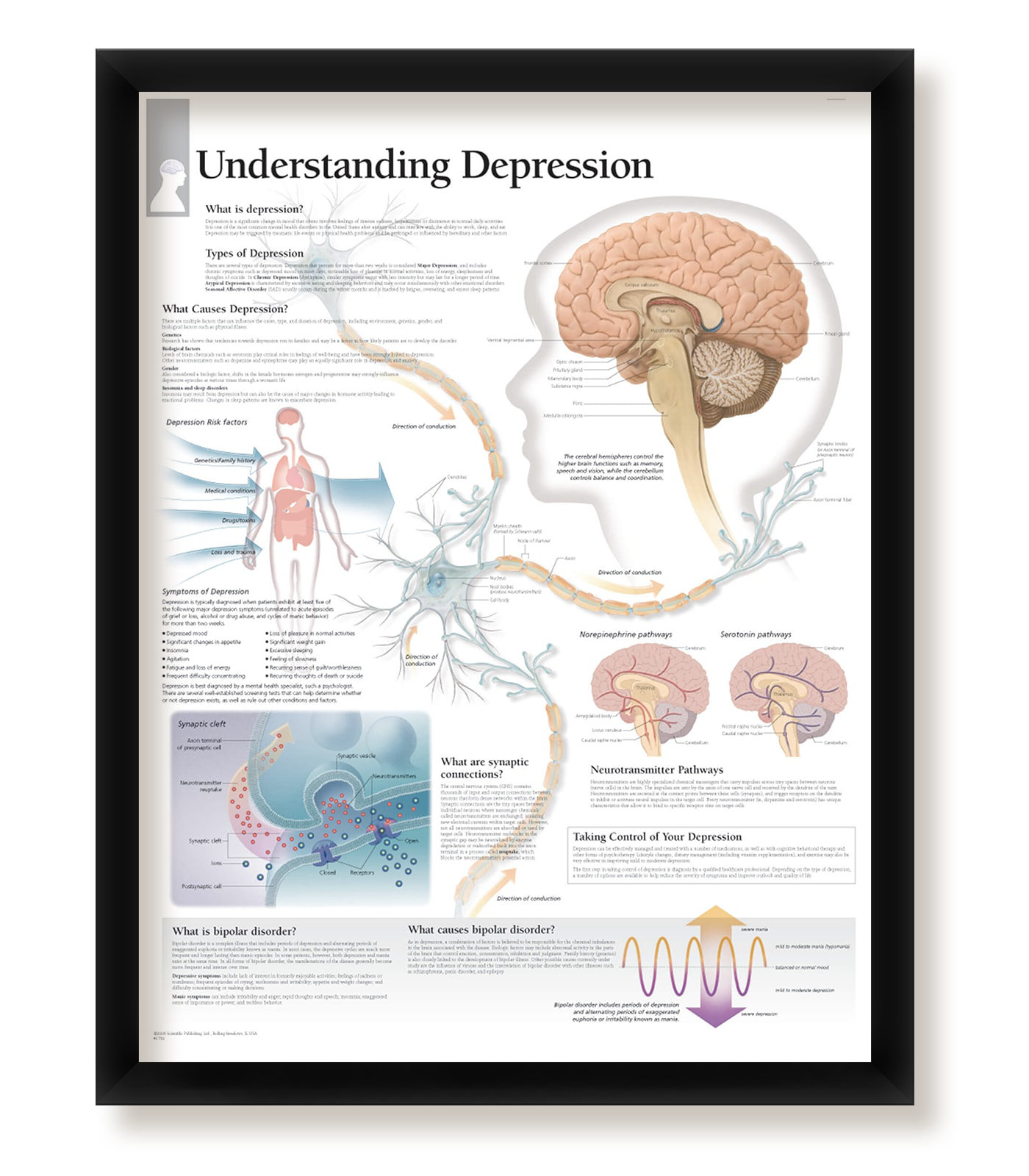 Trinx Javere Understanding Depression Framed Medical Educational ...