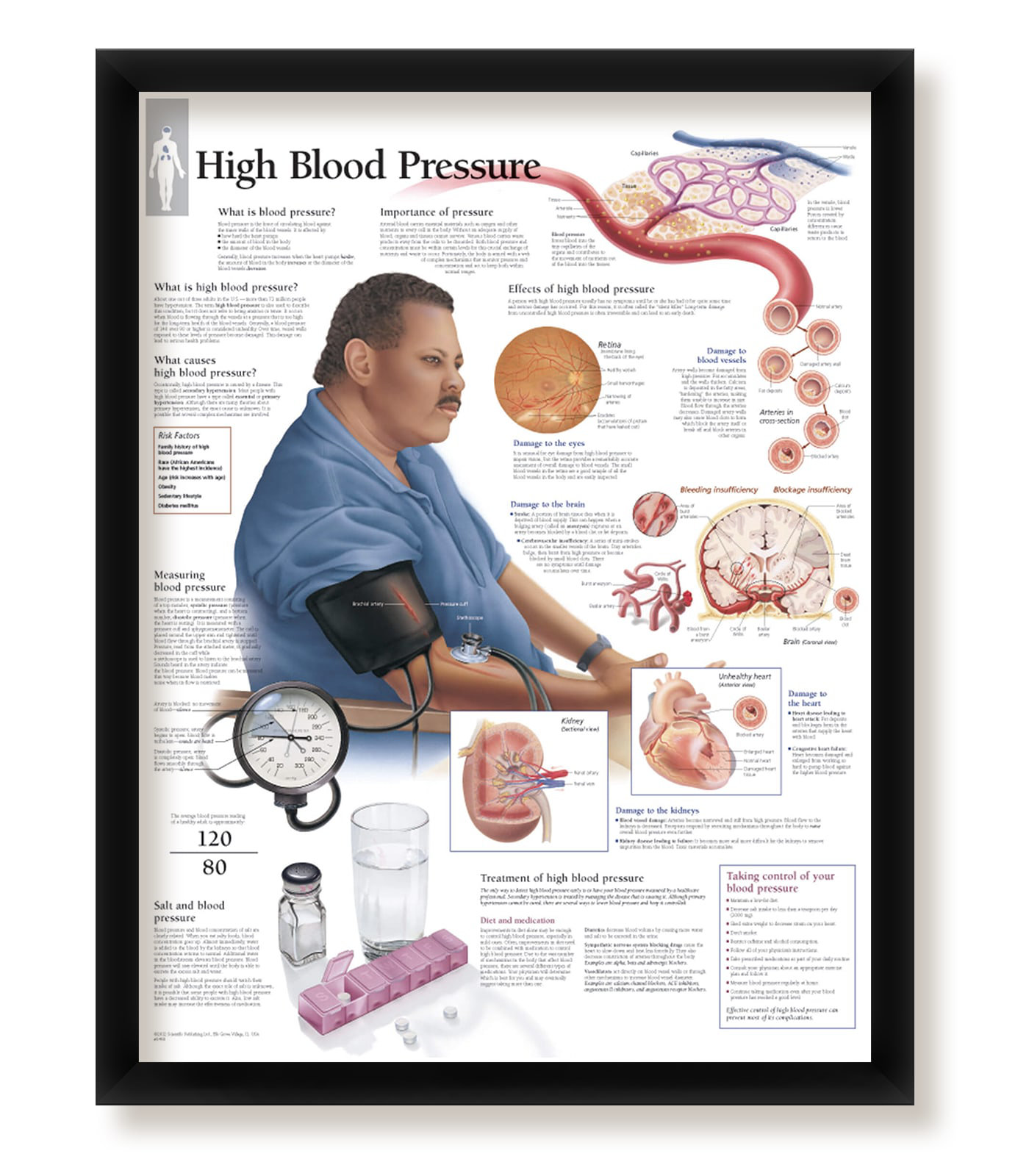 Trinx Jaryan High Blood Pressure Framed Medical Educational ...